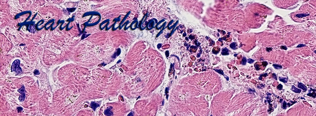 Heart Pathology