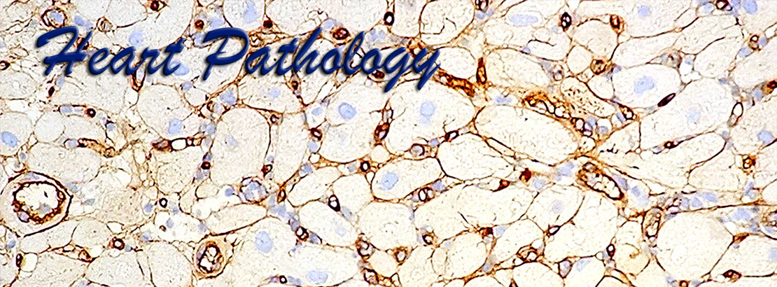 Heart Pathology