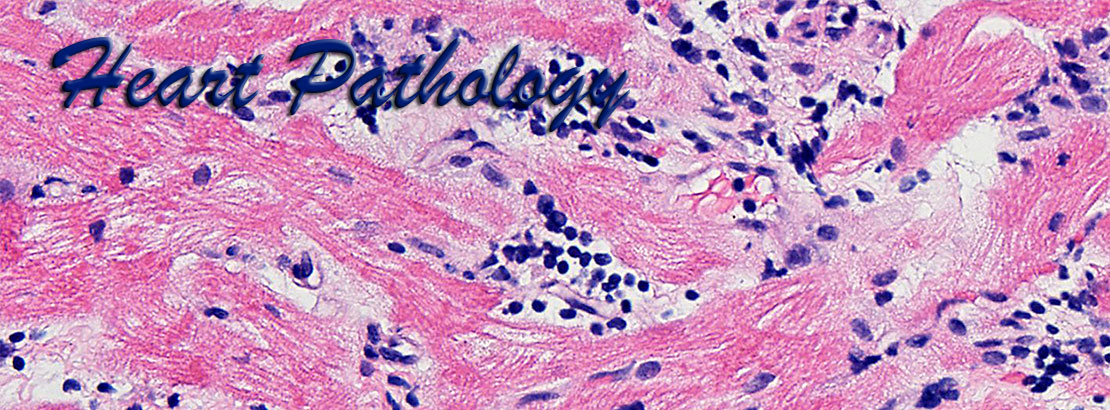 Heart Pathology