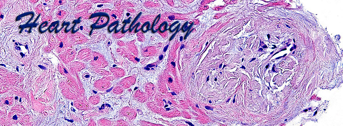 Heart Pathology